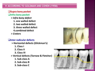 Patterns of bone destruction in periodontics | PPTX