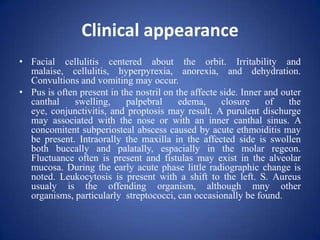 Periostitis | PPTX