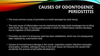 periostitis.pptx dentistry student university | PPTX