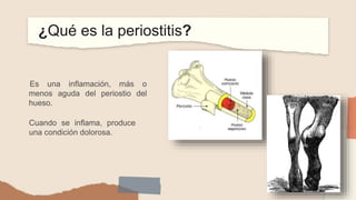 periostitis 21.pptx