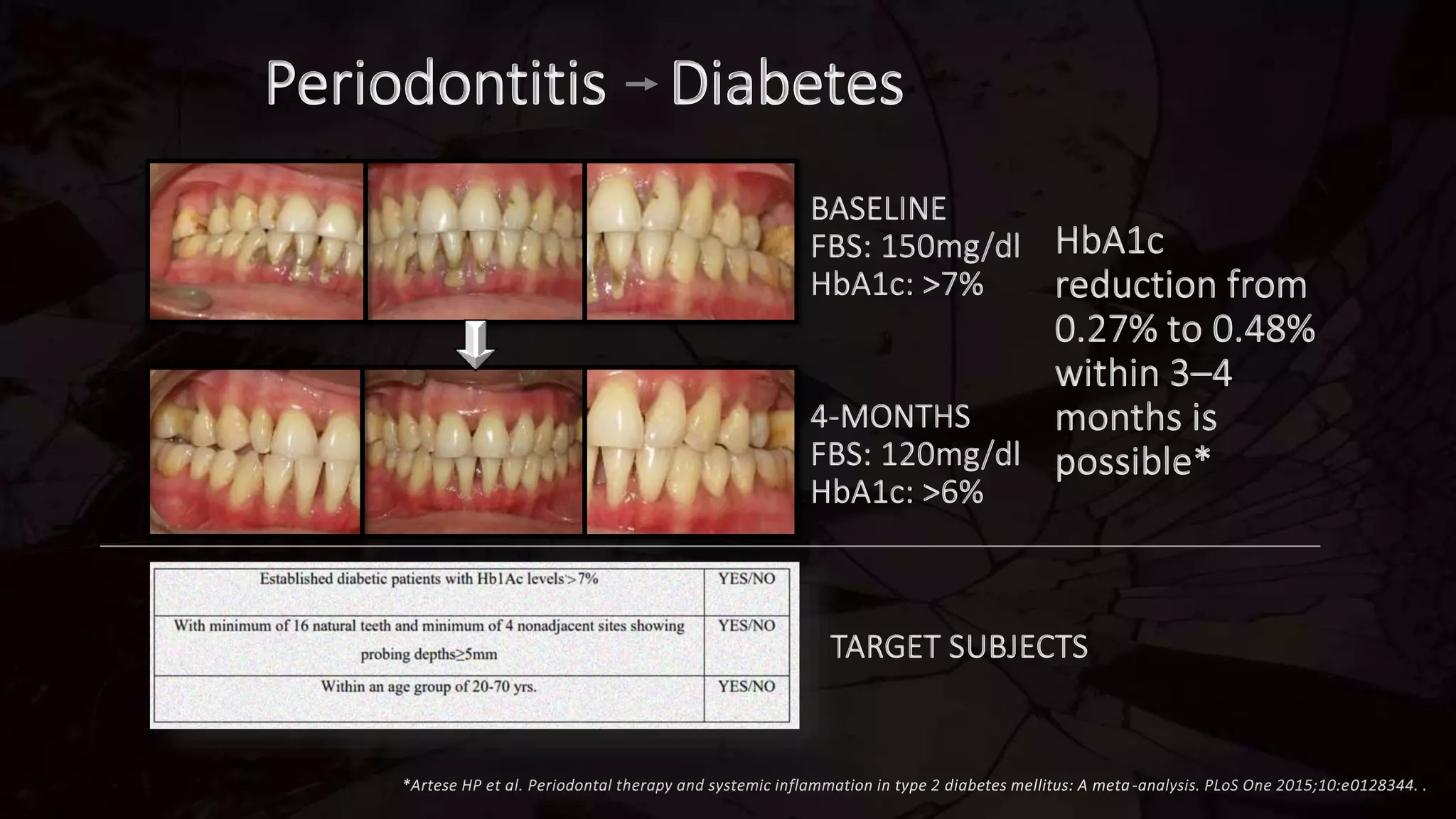 Periodontitis and Systemic Diseases- A Broken Two-way Mirror | PPTX