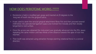 Periotome | PPTX