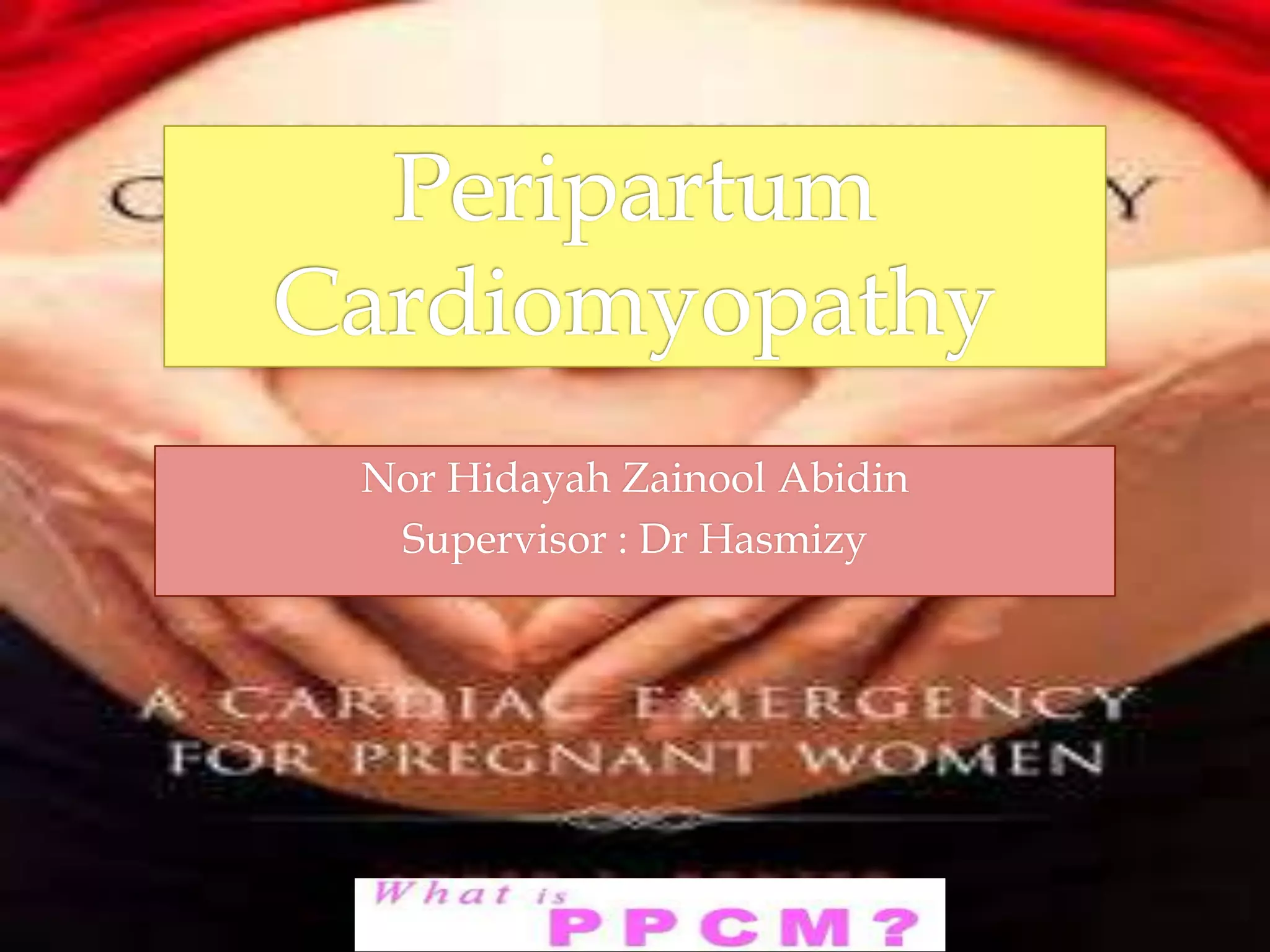 Peripartum cardiomyopathy | PPTX