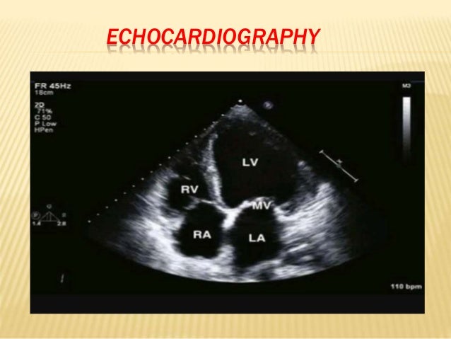 Peripartum cardiomyopathy