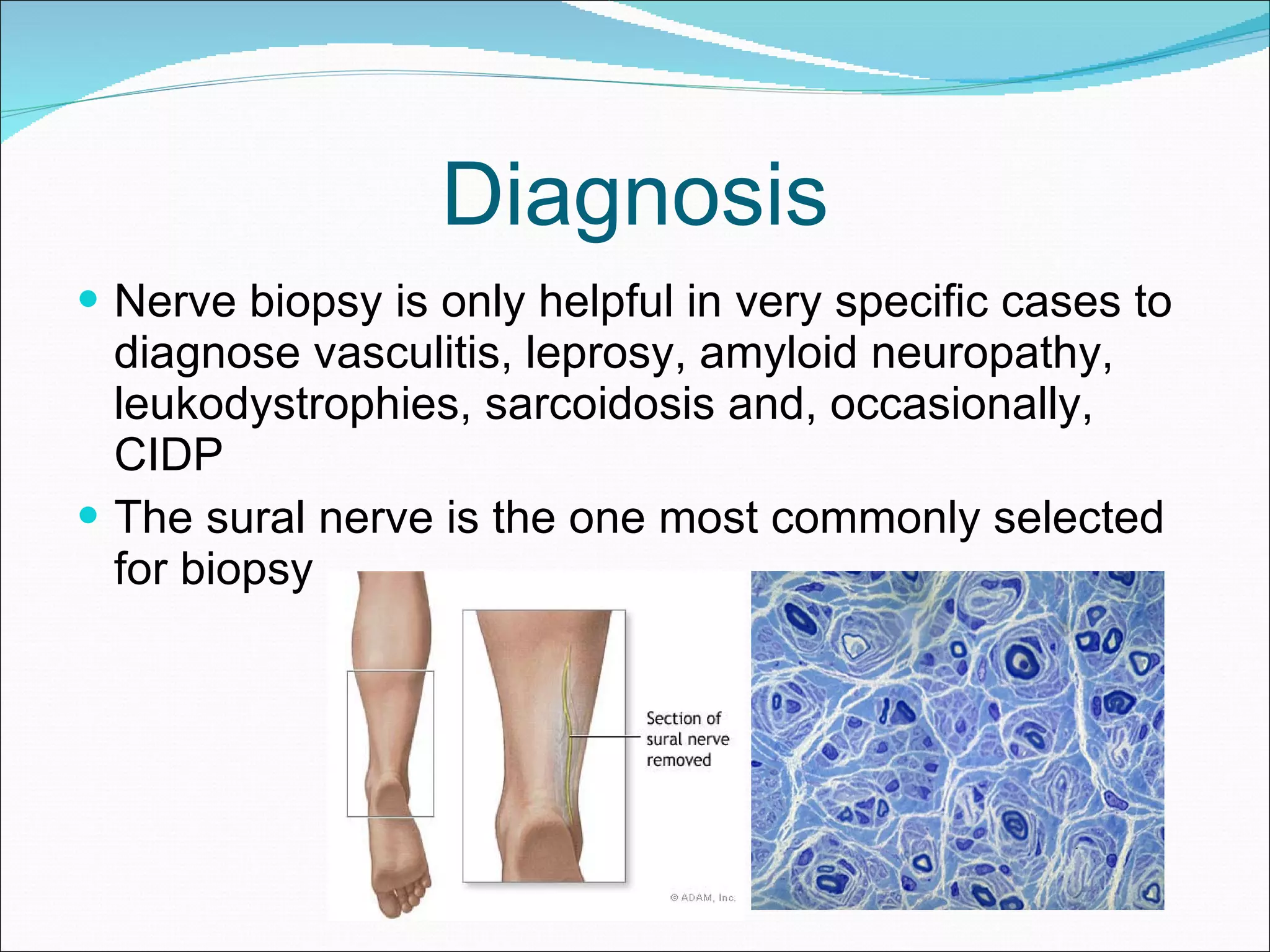 Peripheral Neuropathy an overview | PPT