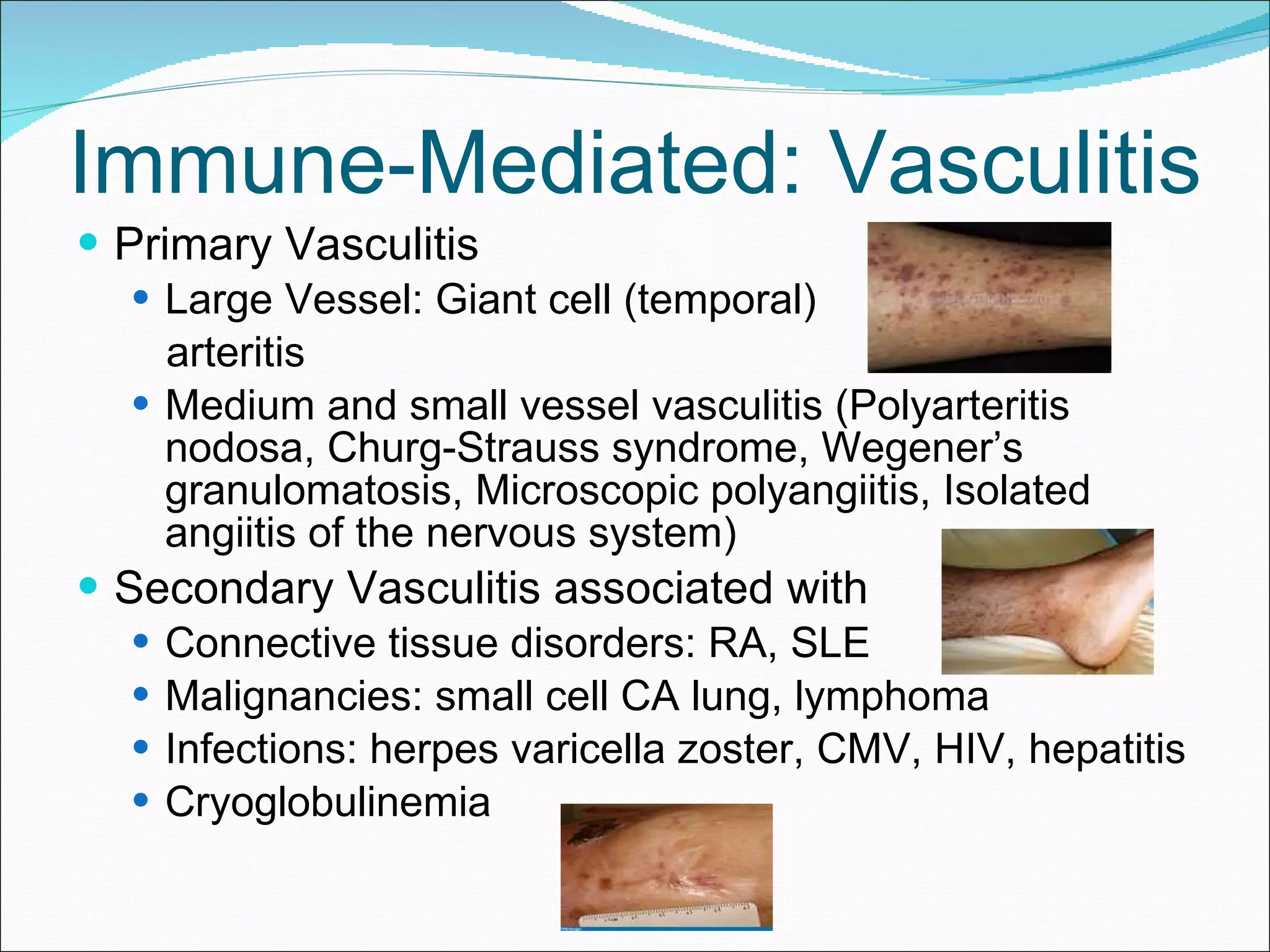 Peripheral Neuropathy an overview | PPT