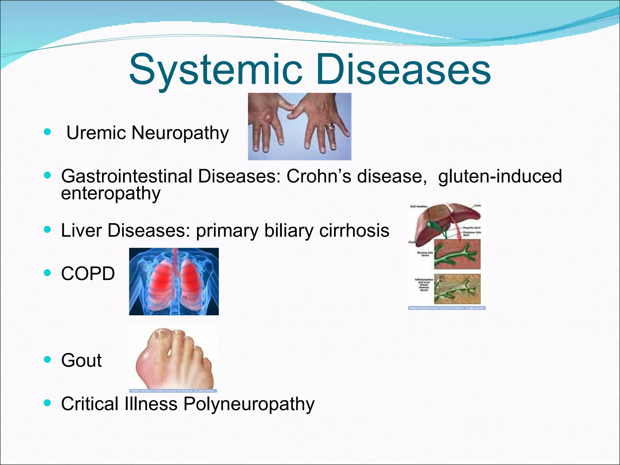 Peripheral Neuropathy an overview | PPT