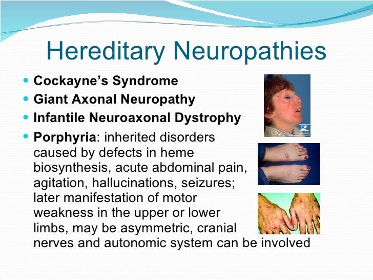 Peripheral Neuropathy an overview