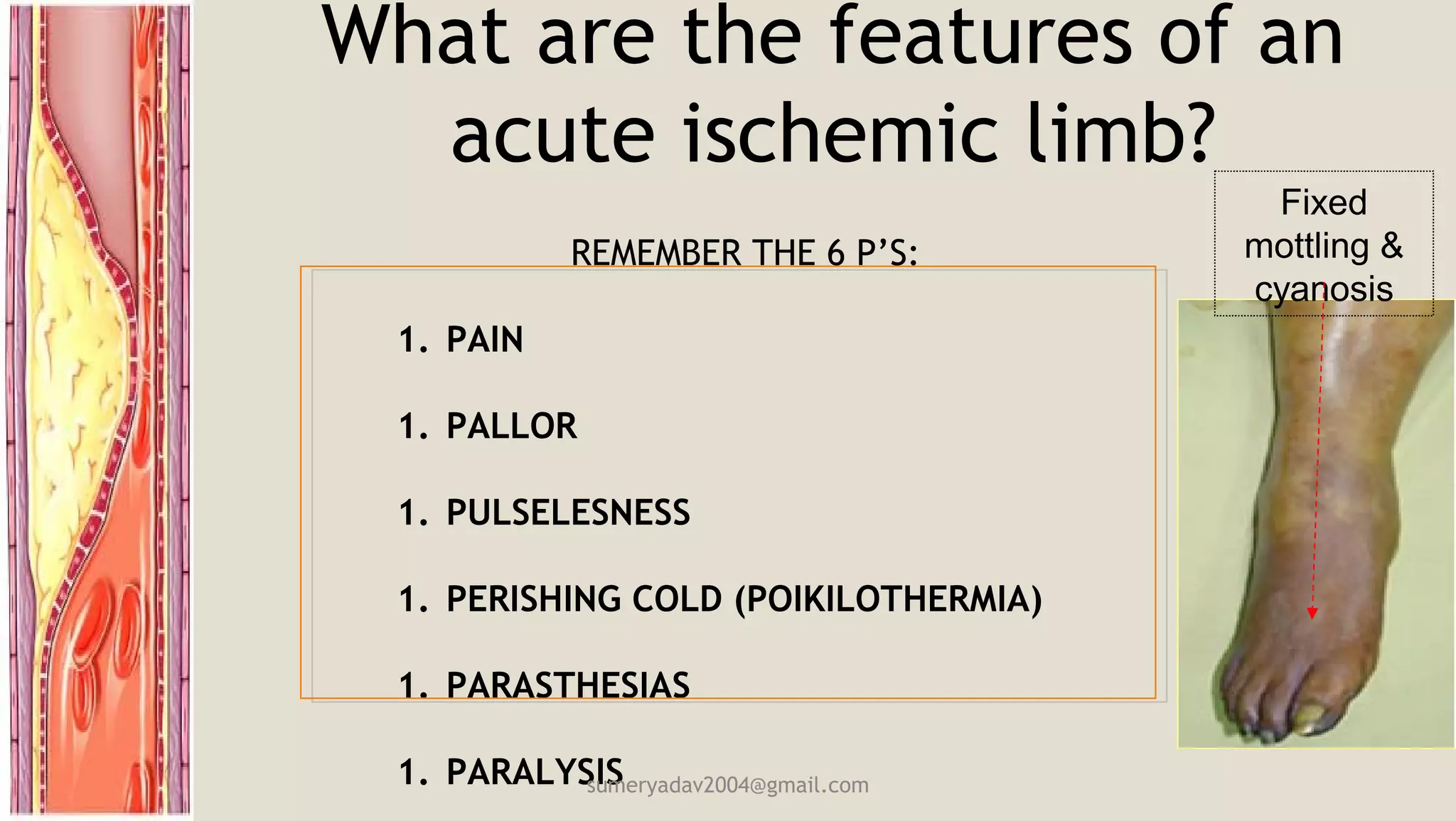 Peripheral vascular disease and Clinical features of acute and chronic ...