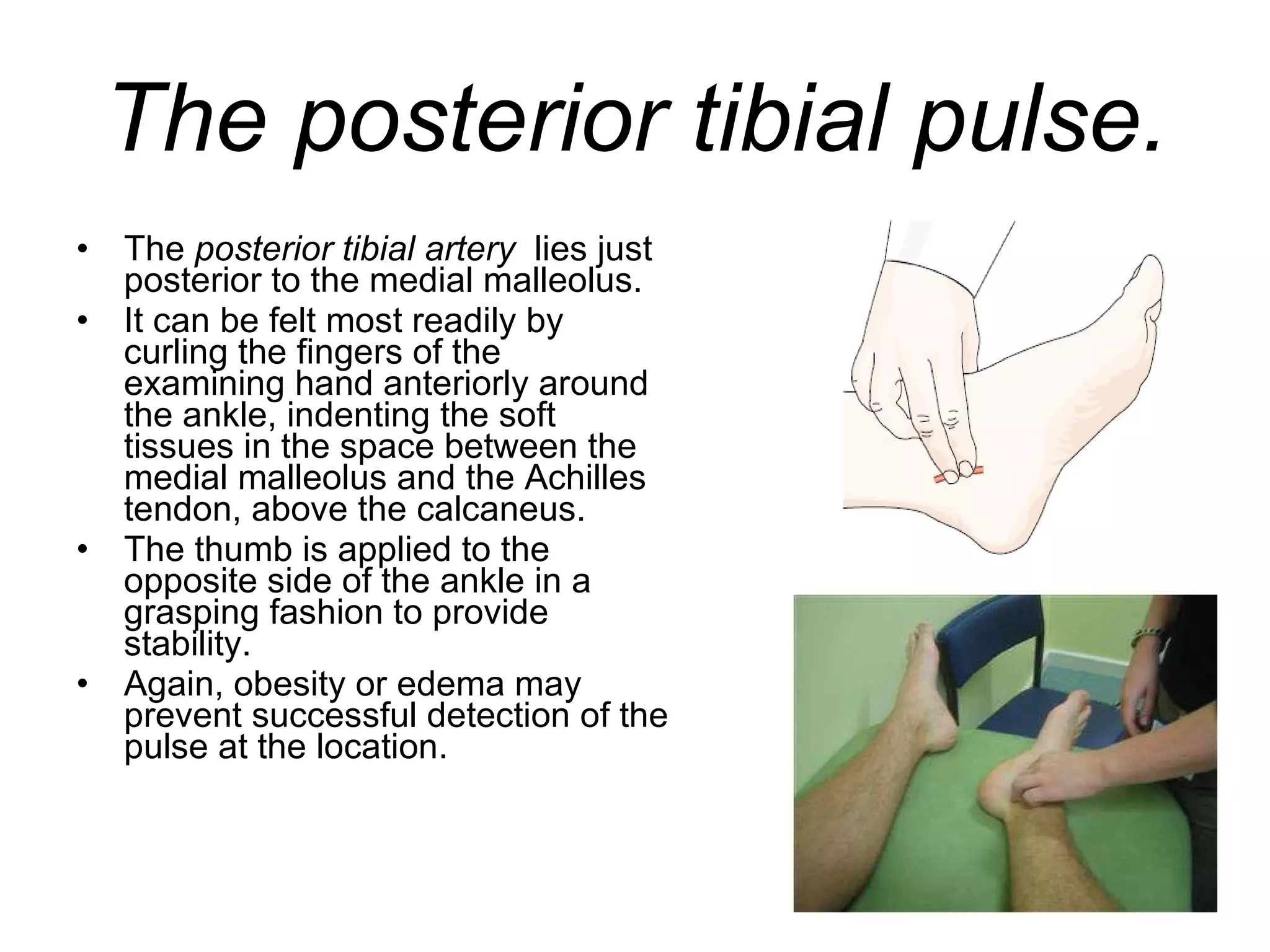 Peripheral Vascular Examination | PPT