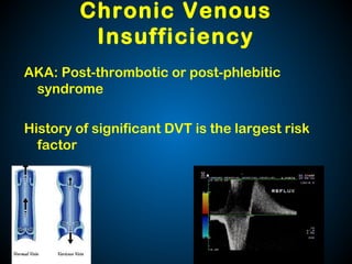 Venous Disease: Peripheral and Embolic | PPT