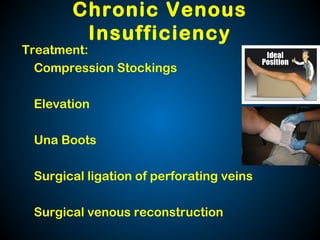 Venous Disease: Peripheral and Embolic | PPT