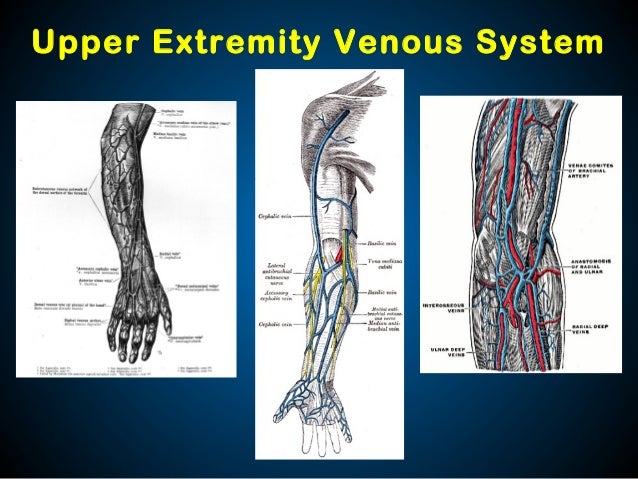 Venous Disease: Peripheral and Embolic
