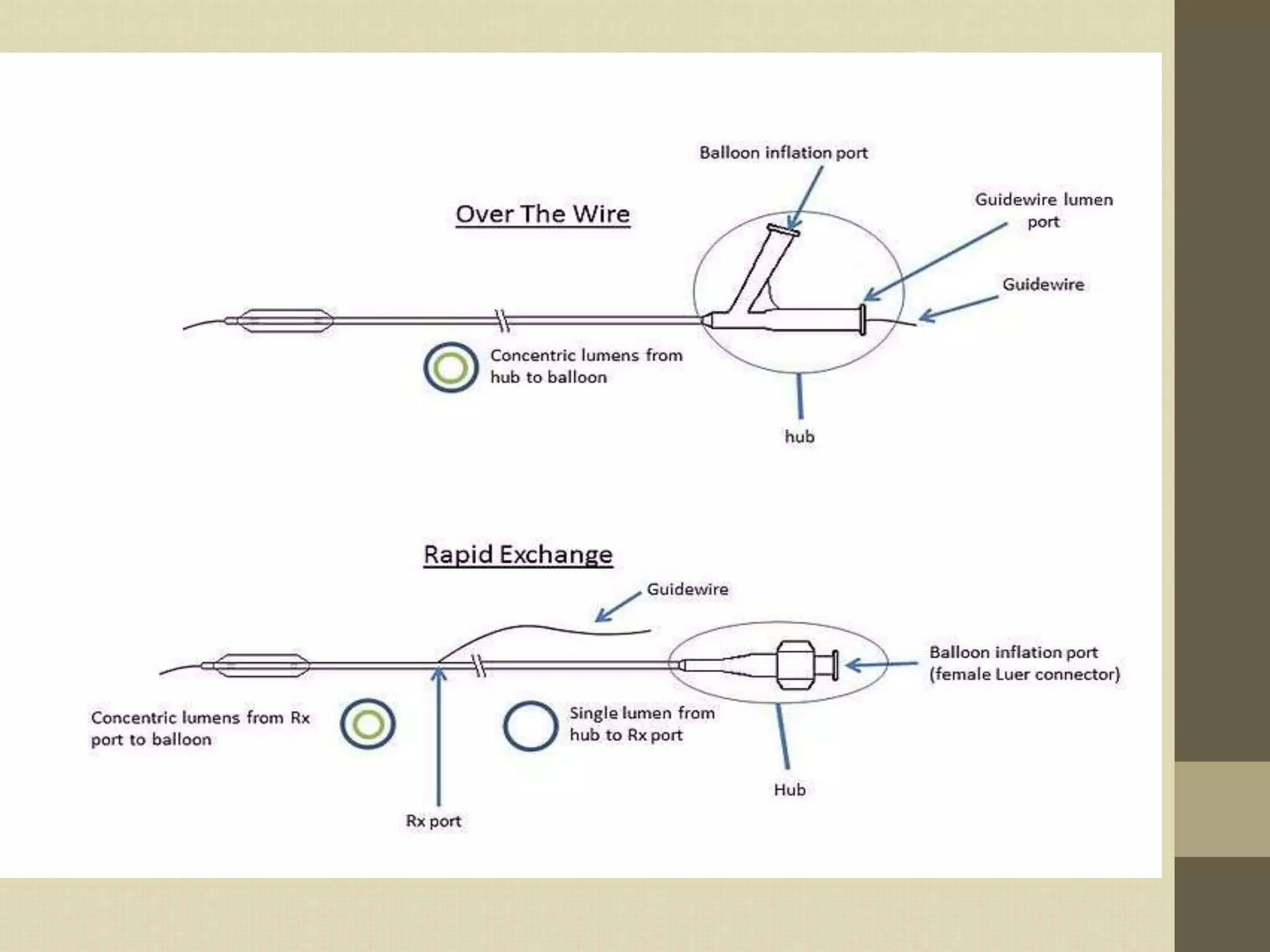 Peripheral angiography | PPTX