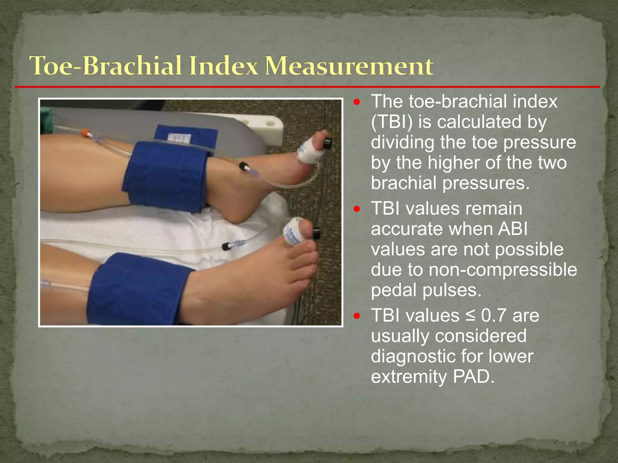 Peripheral arterial disease | PPTX