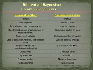 Peripheral arterial disease | PPTX