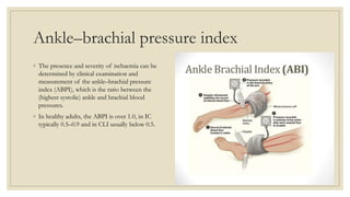 Peripheral Arterial Disease.pptx