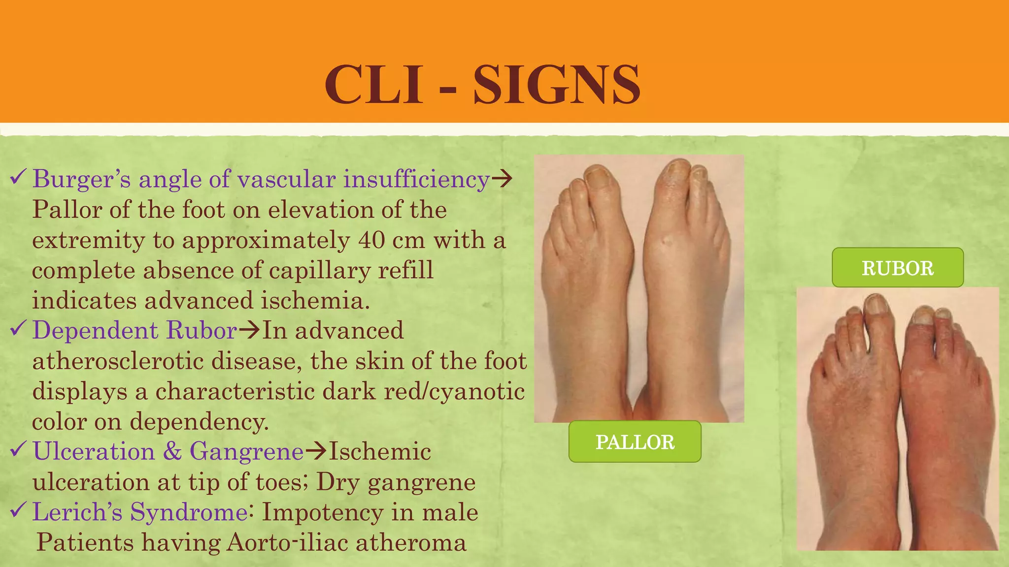 Peripheral arterial diseases | PDF