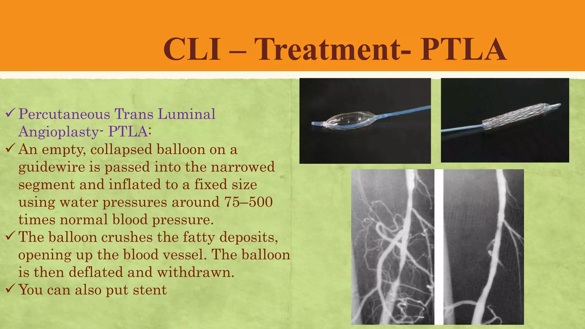 Peripheral arterial diseases | PDF