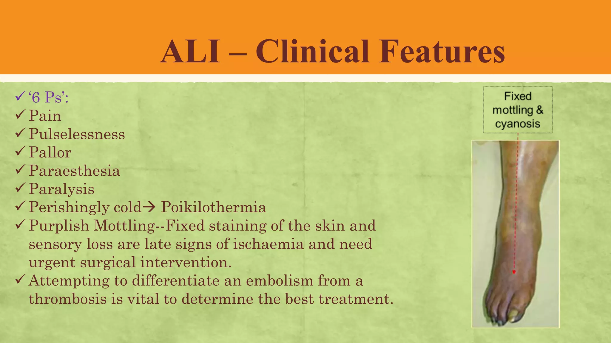 Peripheral arterial diseases | PDF