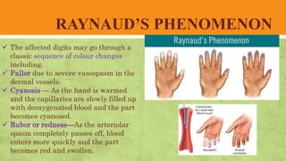 Peripheral arterial diseases | PDF