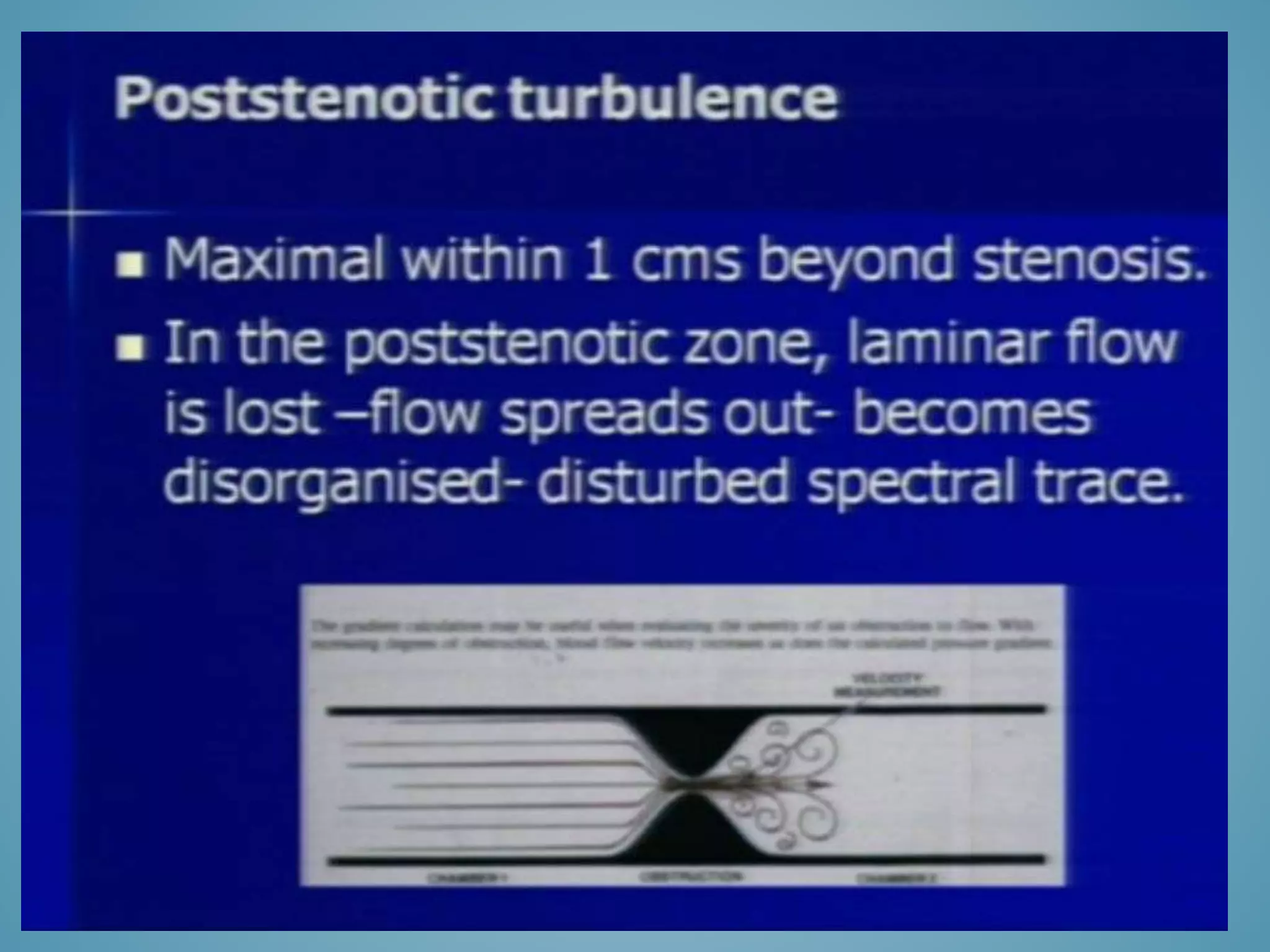 Peripheral arterial doppler | PPTX
