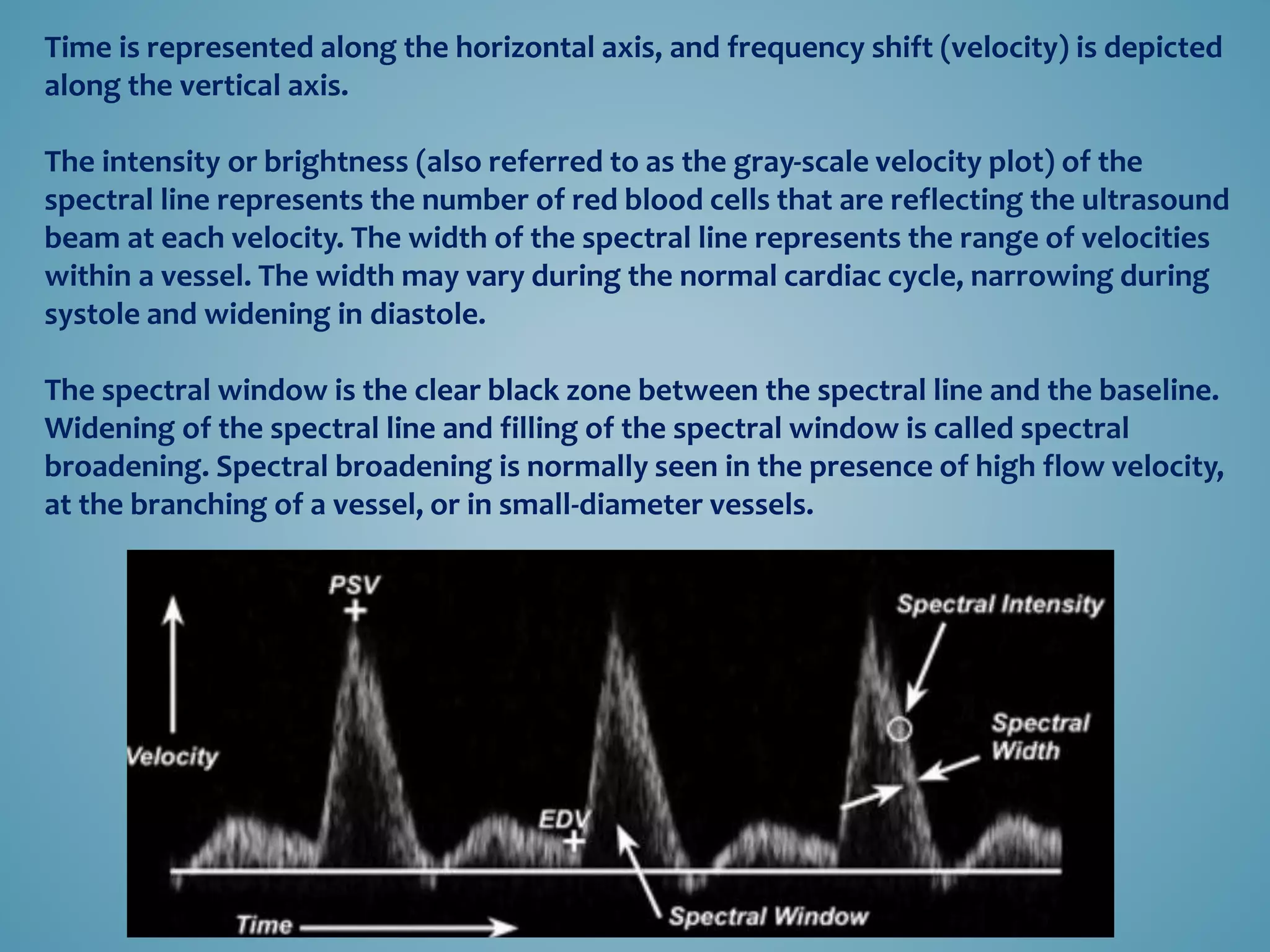 Peripheral arterial doppler | PPTX