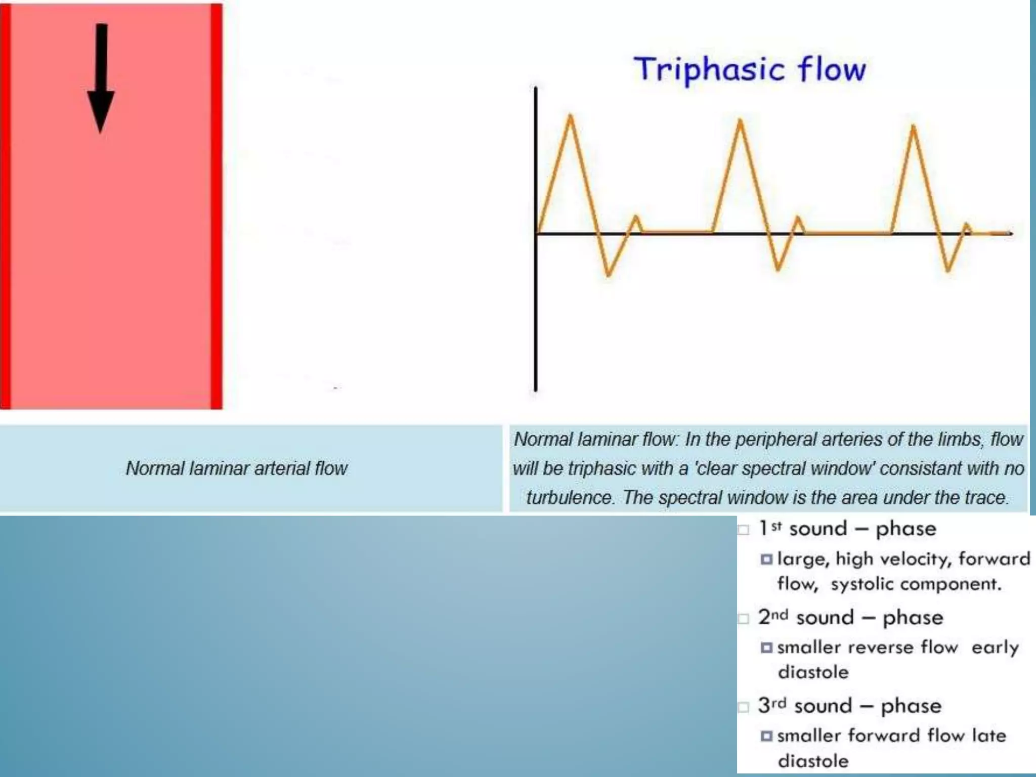 Peripheral arterial doppler | PPTX