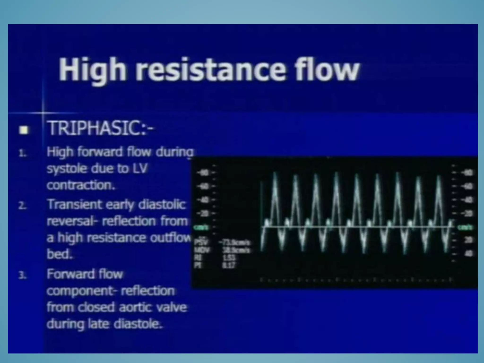 Peripheral arterial doppler | PPTX