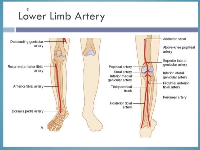 Peripheral arterial doppler | PPTX | Blood Disorders | Diseases and ...