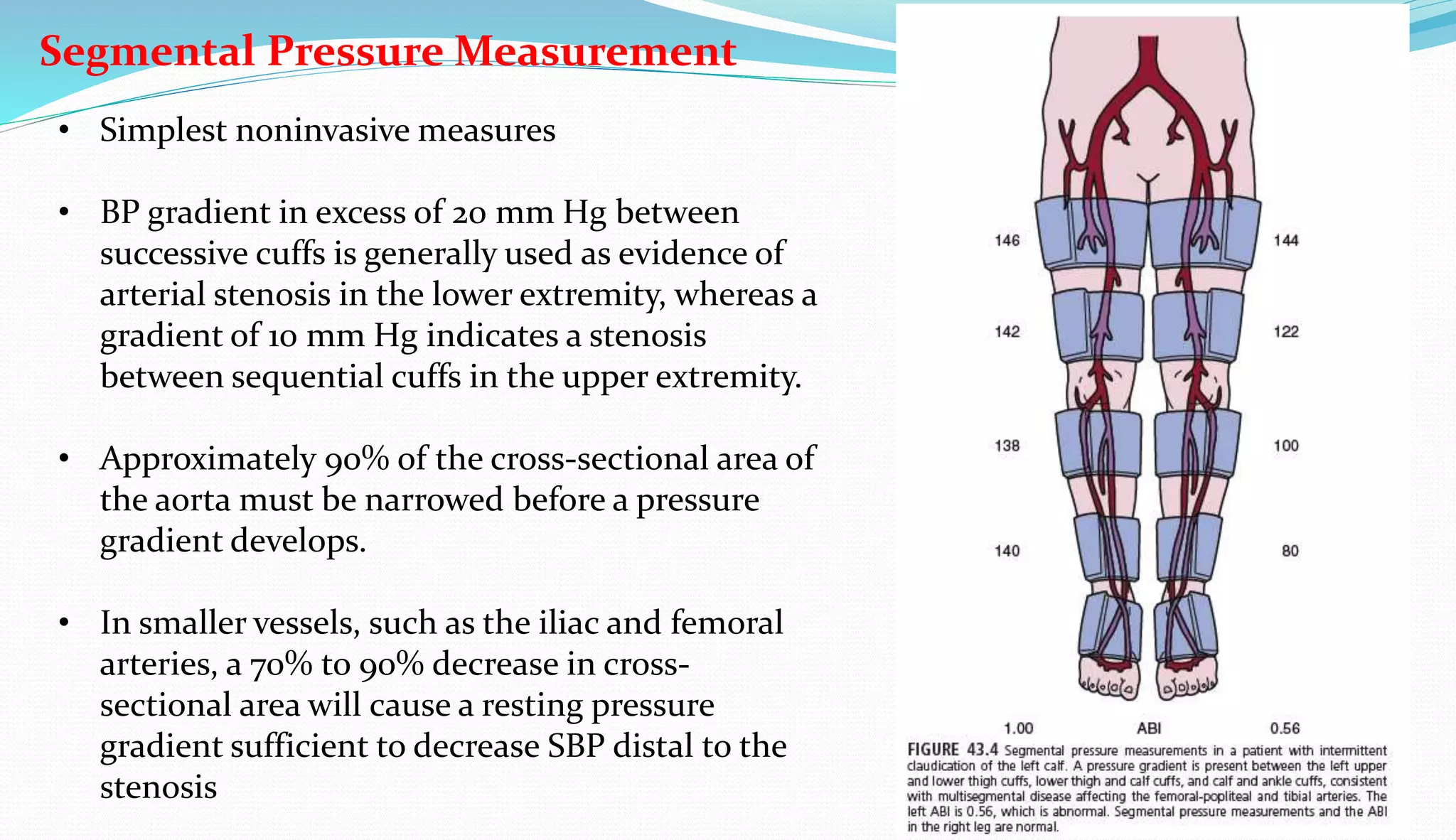Peripheral artery disease | PPTX
