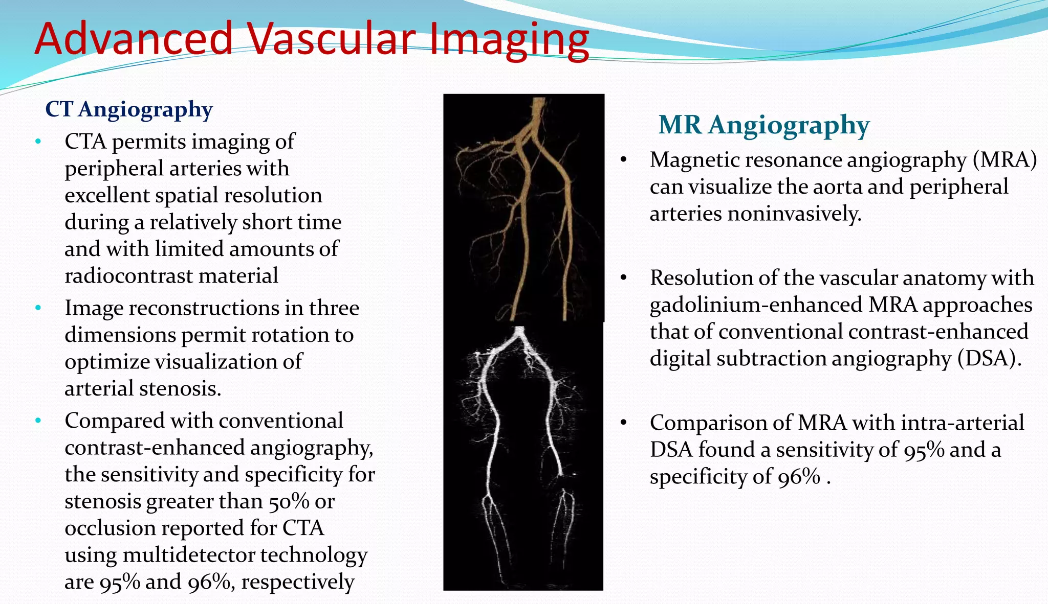 Peripheral artery disease | PPTX