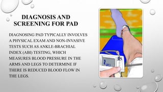 Peripheral Artery Disease.pptx