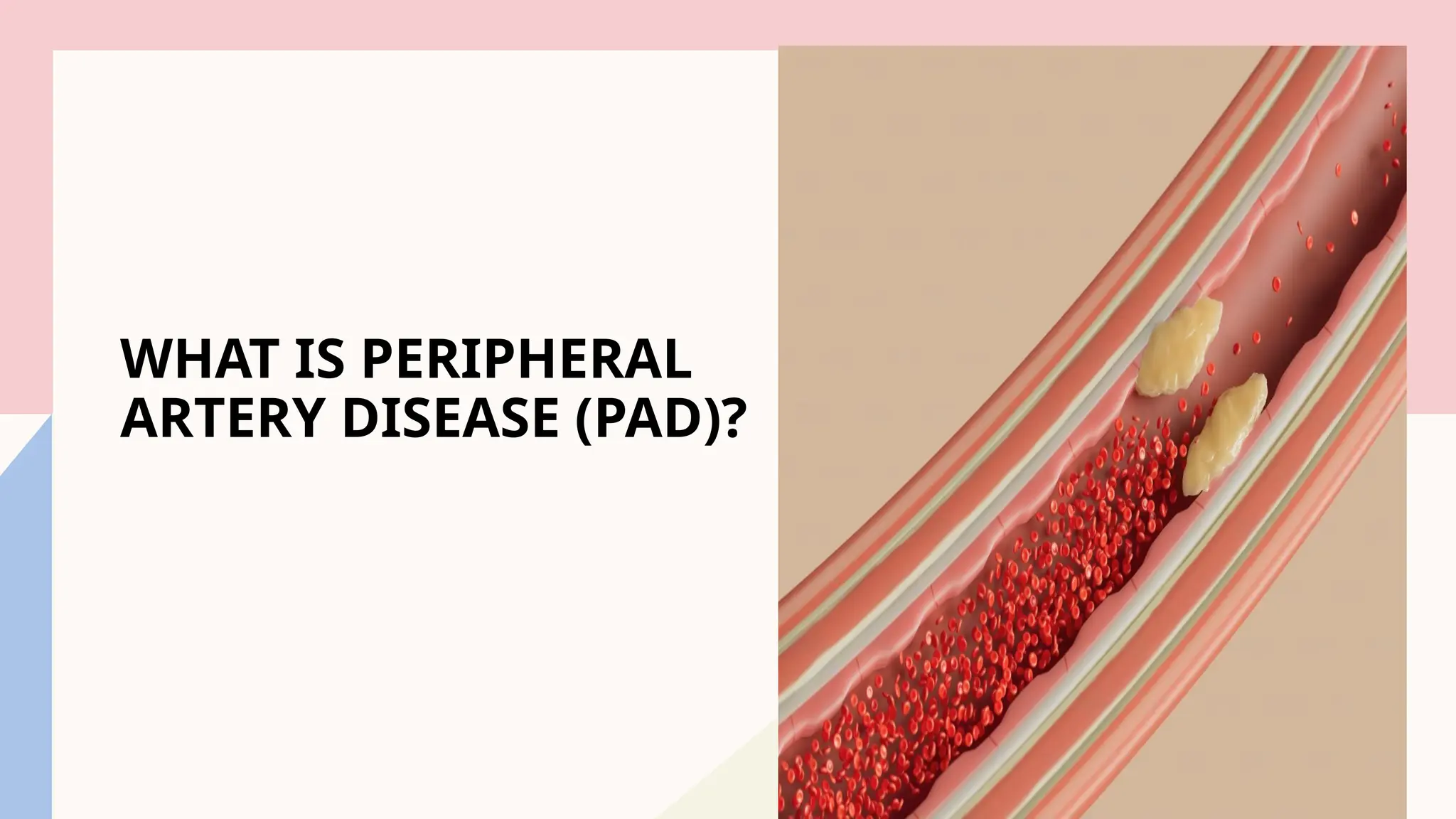 Peripheral Artery Disease and Heart Health.pptx