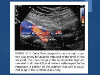 Peripheral Arterial Doppler: Assessment of Upper and Lower limb ...