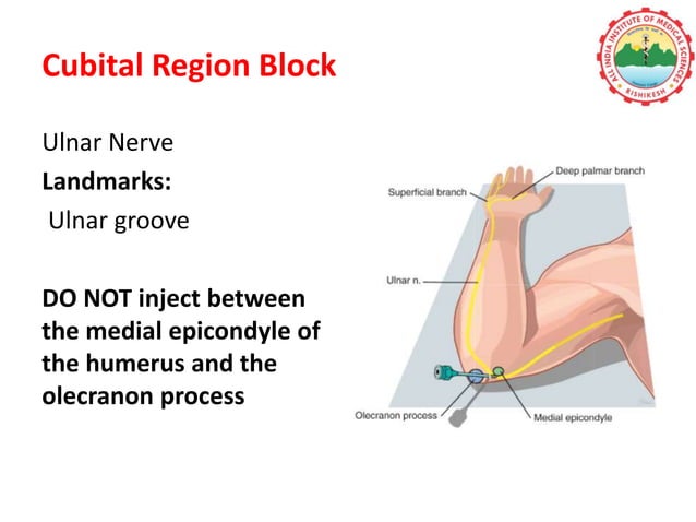 Peripheral blocks | PPT