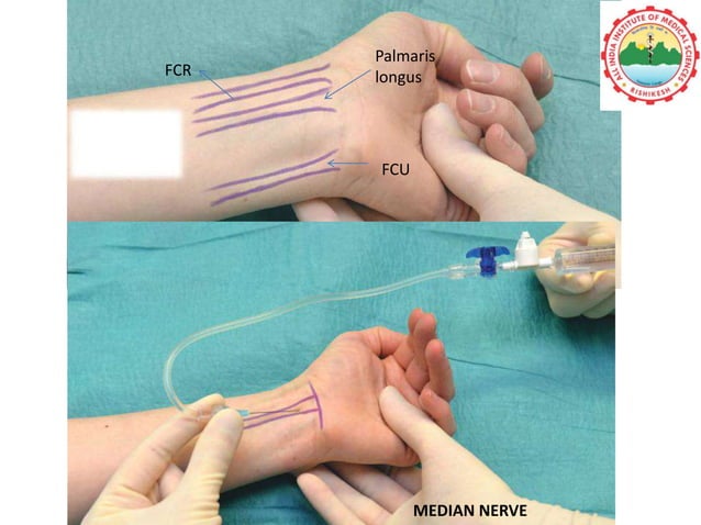 Peripheral blocks | PPT