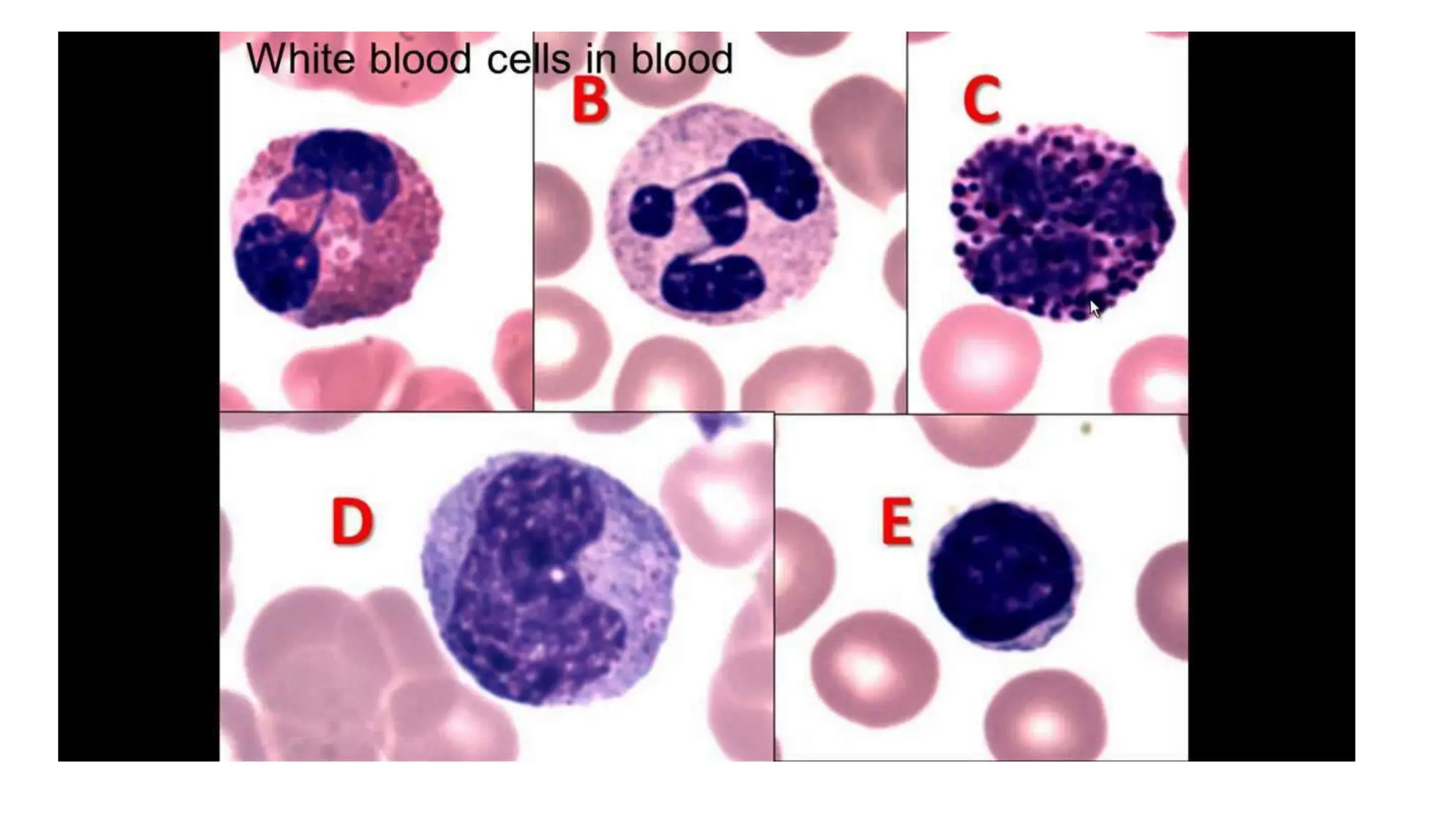 Peripheral blood film and GS for imm.pptx | Blood Disorders | Diseases ...