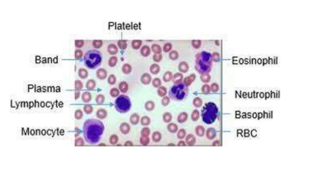 Peripheral blood film and GS for imm.pptx | Blood Disorders | Diseases ...