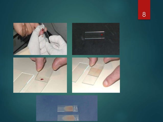 Peripheral Blood Smear | PPTX