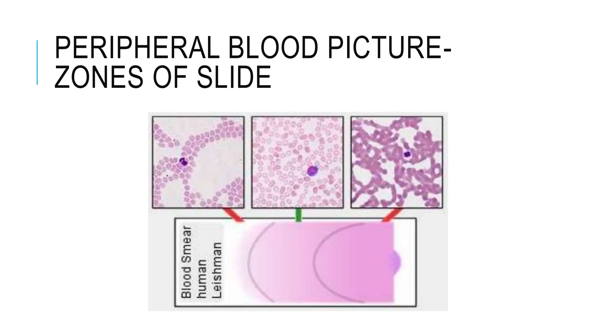 PERIPHERAL BLOOD SMEAR examinationn.pptx