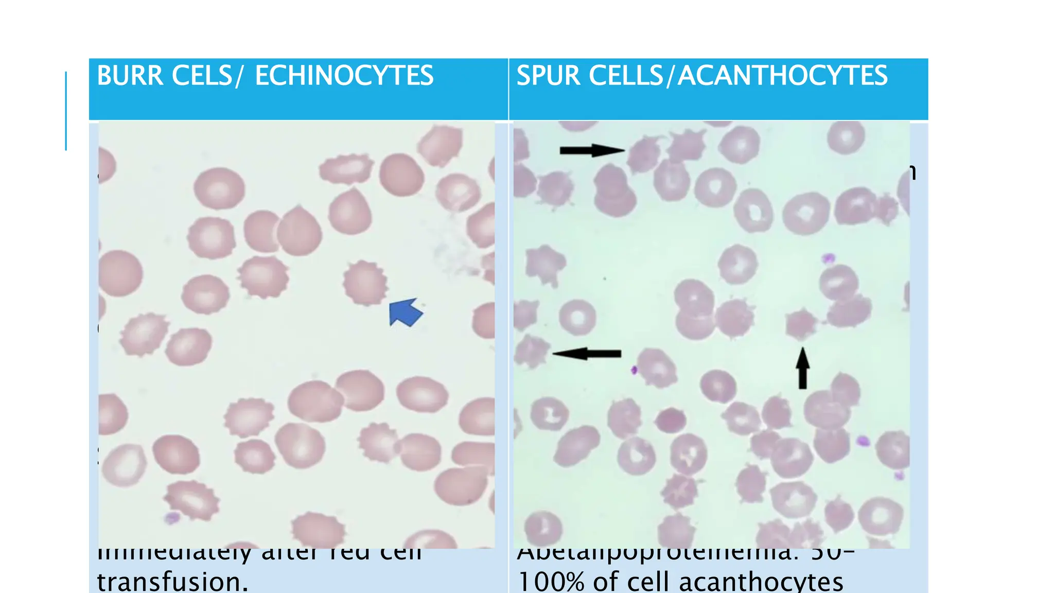 PERIPHERAL BLOOD SMEAR examinationn.pptx