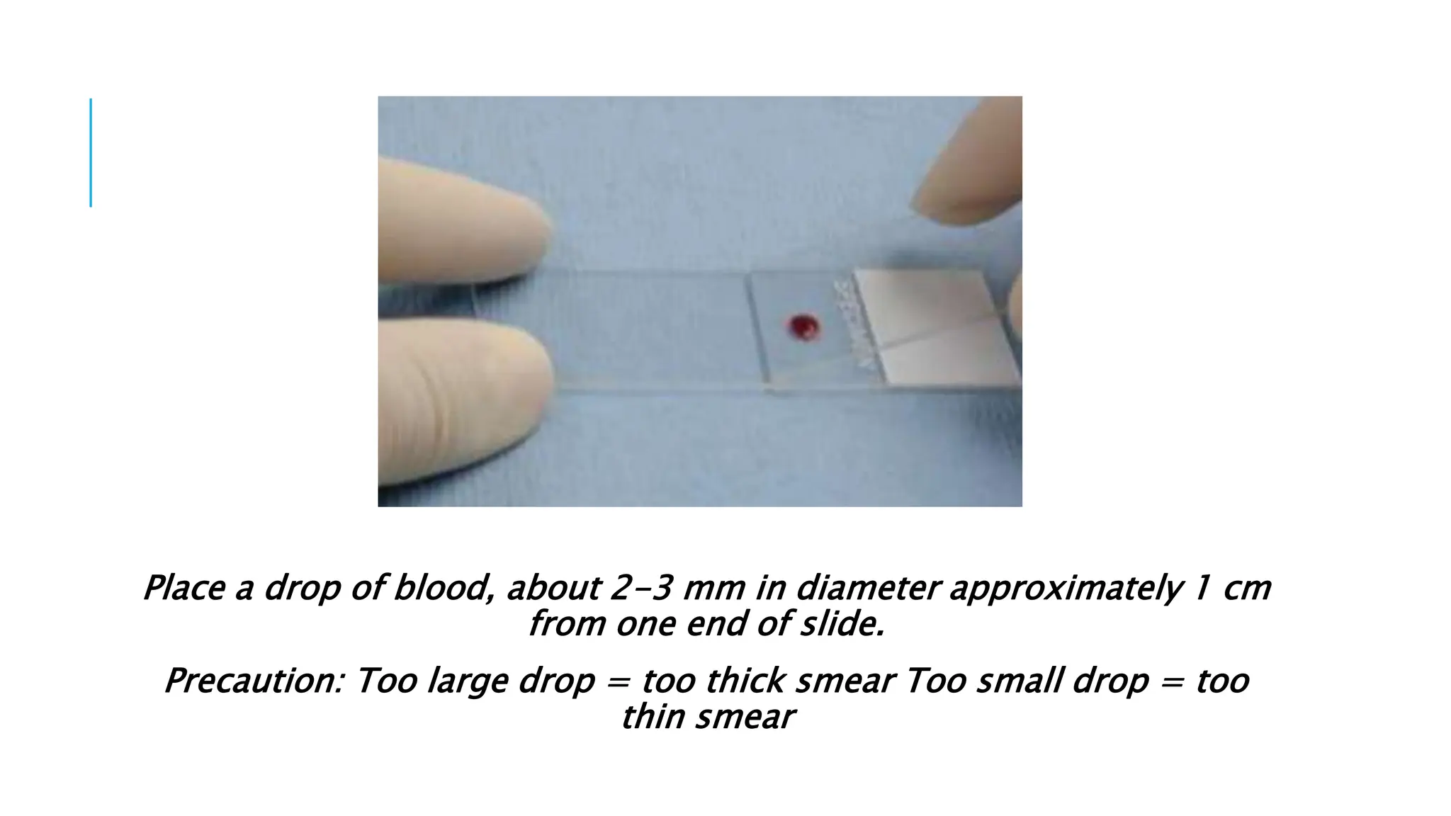 PERIPHERAL BLOOD SMEAR examinationn.pptx