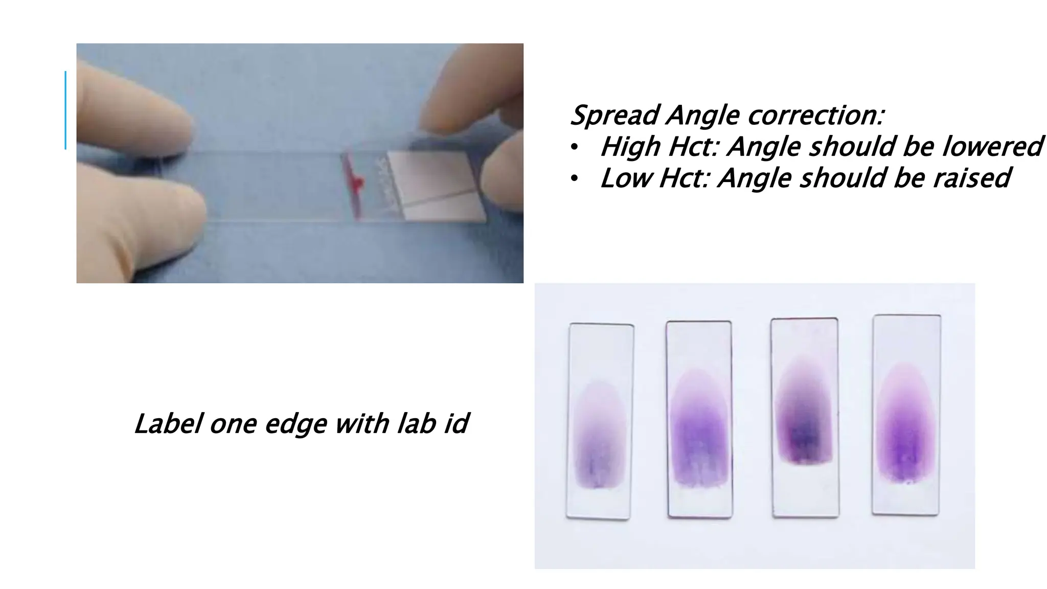 PERIPHERAL BLOOD SMEAR examinationn.pptx