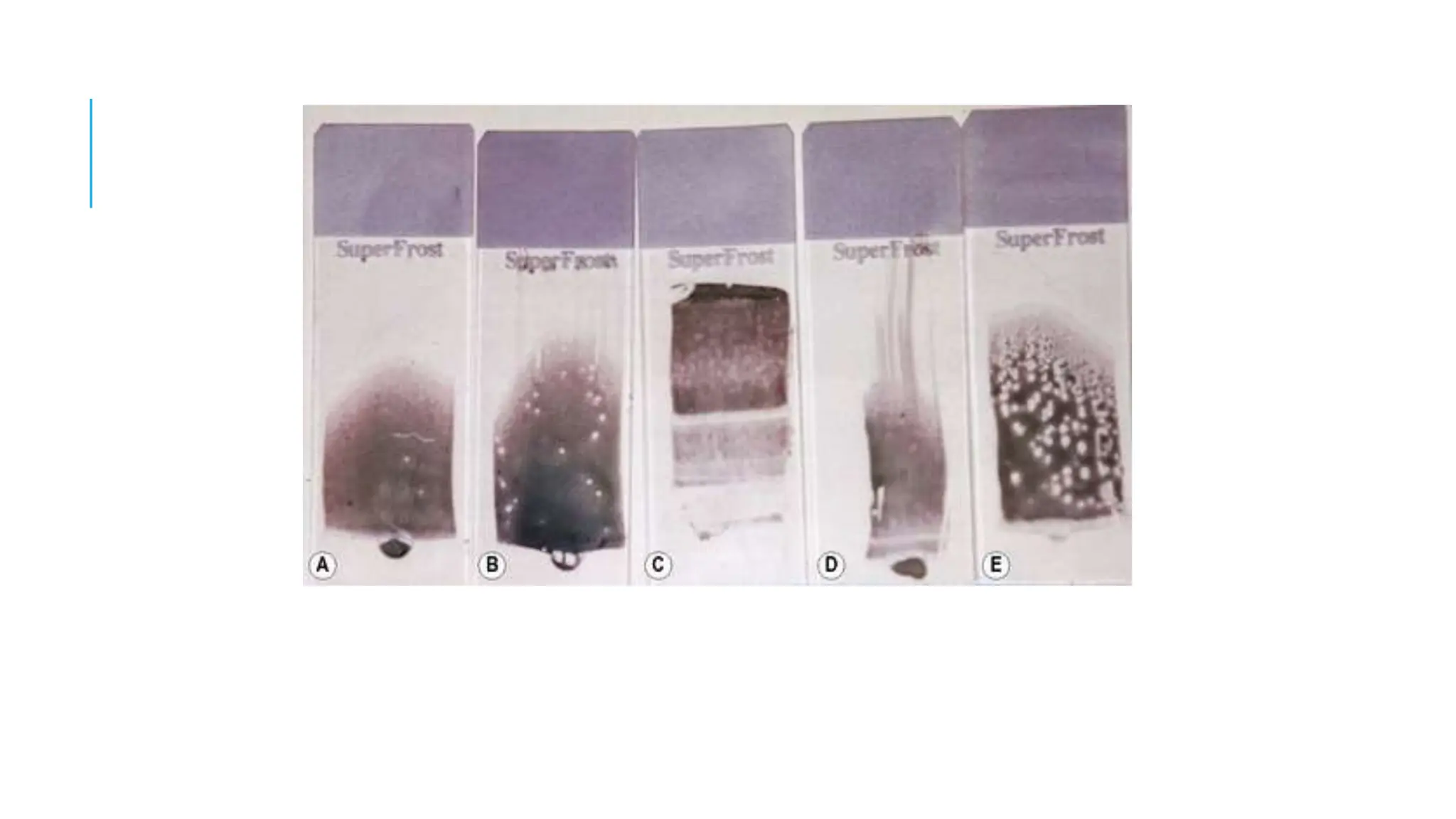 PERIPHERAL BLOOD SMEAR examinationn.pptx