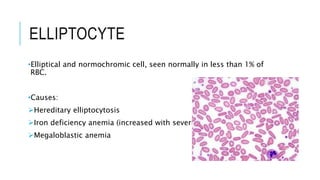 PERIPHERAL BLOOD SMEAR examinationn.pptx
