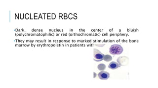 PERIPHERAL BLOOD SMEAR examinationn.pptx