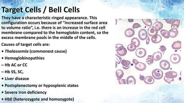PERIPHERAL BLOOD SMEAR (STAINING, CELLS AND CONDITIONS) | PPTX
