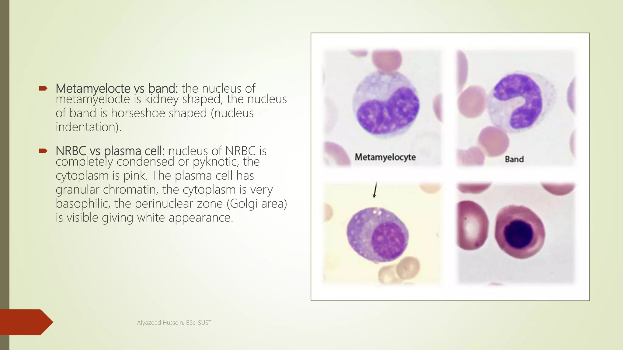 Peripheral blood smear 2020 | PPTX