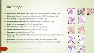 Peripheral blood smear 2020 | PPTX